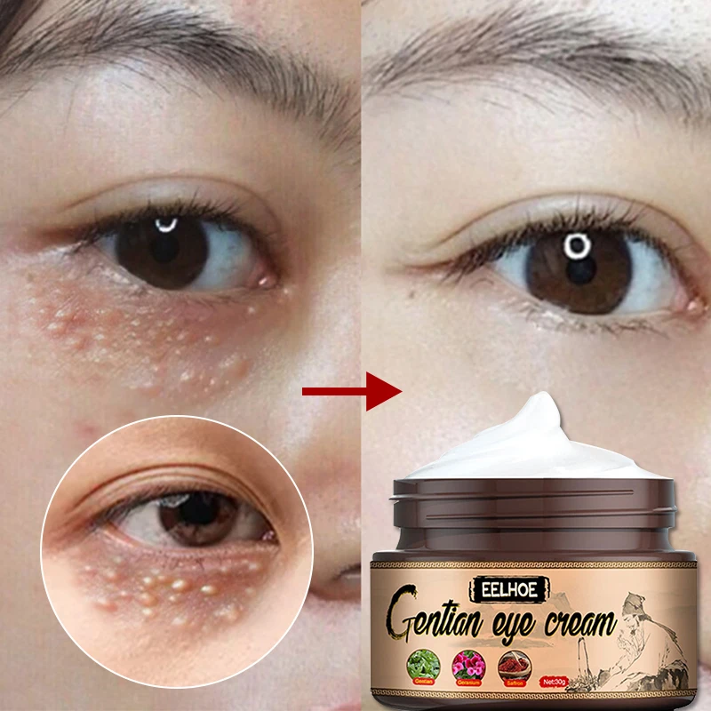 30g Effective Removes Fat Granules Eyes Cream Improve Eye Bag Fine ...