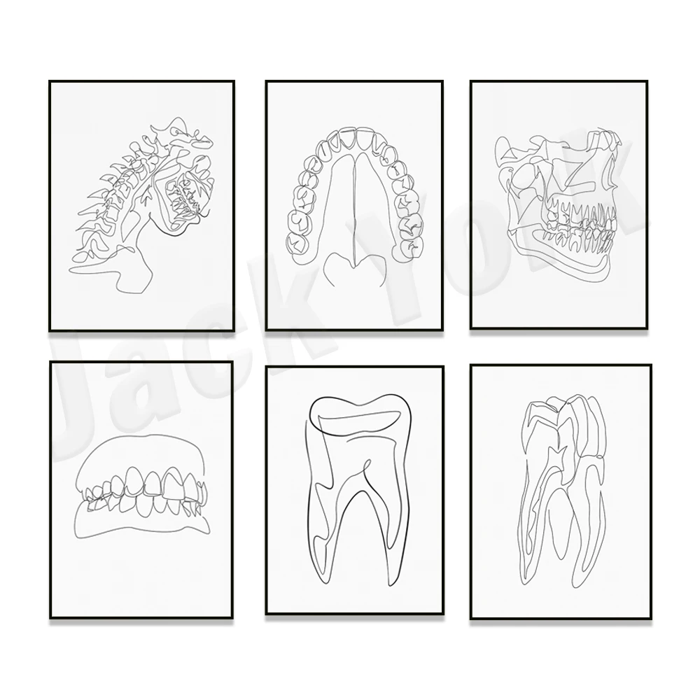 Wisdom Tooth Drawing