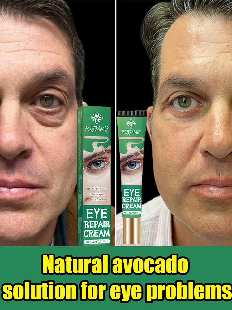 100% solution to eye problems natural avocado - AliExpress 66