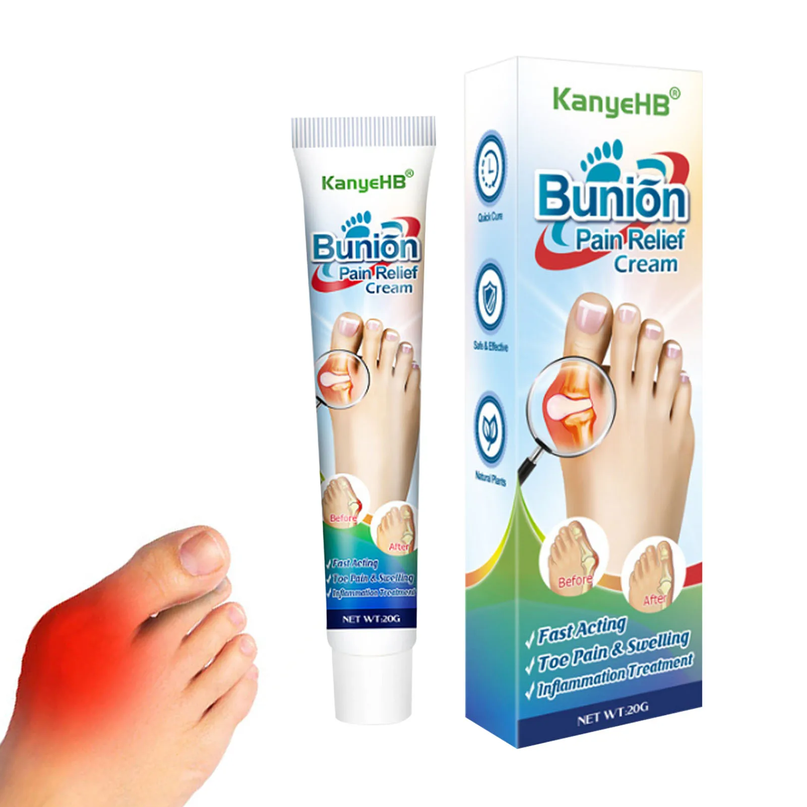 20g Bunion Gout Pain Relief Ointment Toe Joint Valgus Corrector Cream ...