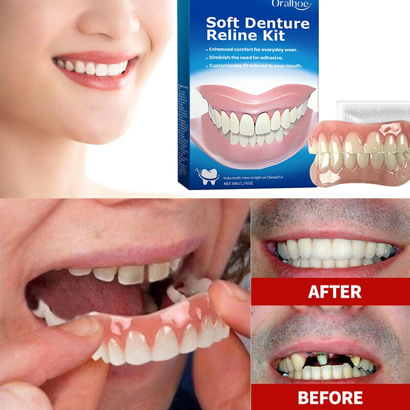 Denture-Silicone-Kit-Denture-Silicone-Liners-Soft-Denture-Kit-Soft ...