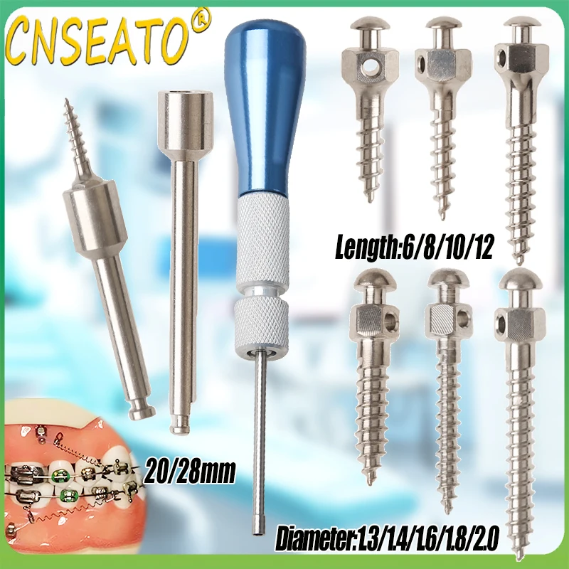 10 Uds Microimplantes dentales Mini tornillo tornillos de anclaje de ...