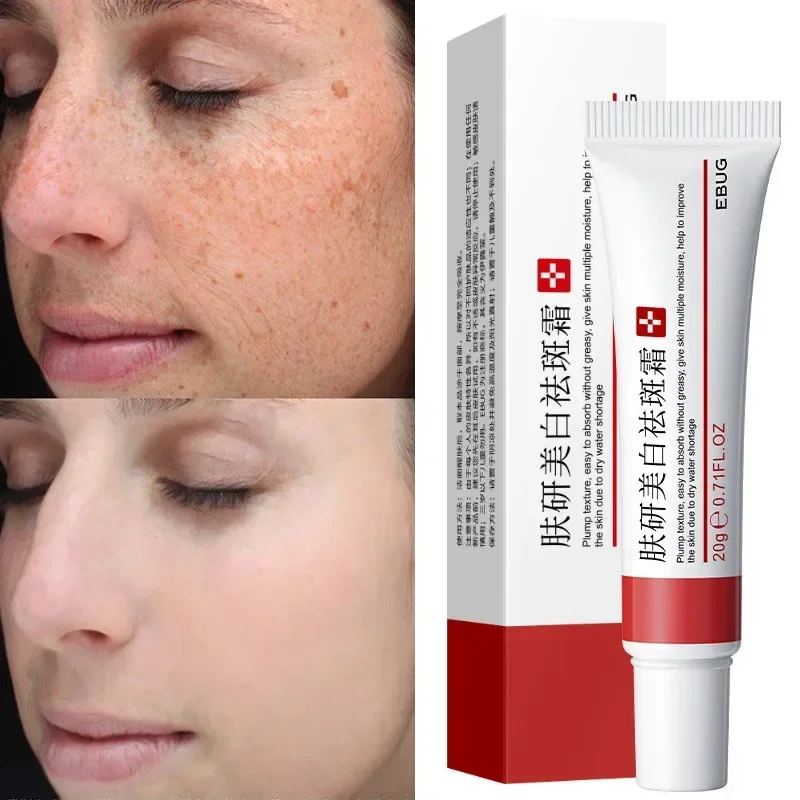 Niacinamide Whitening Cream Remove Dark Spots Anti Aging Freckle ...
