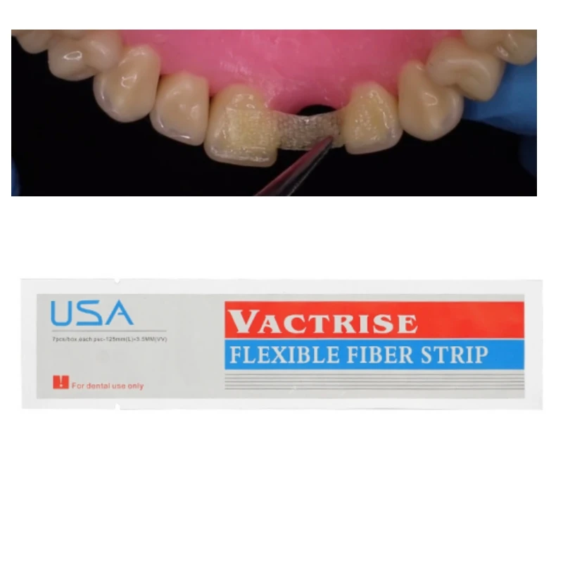Dental-Glass-Fiber-Strip-Loose-Tooth-Band-Retainer-Light-Cure-Bonding ...