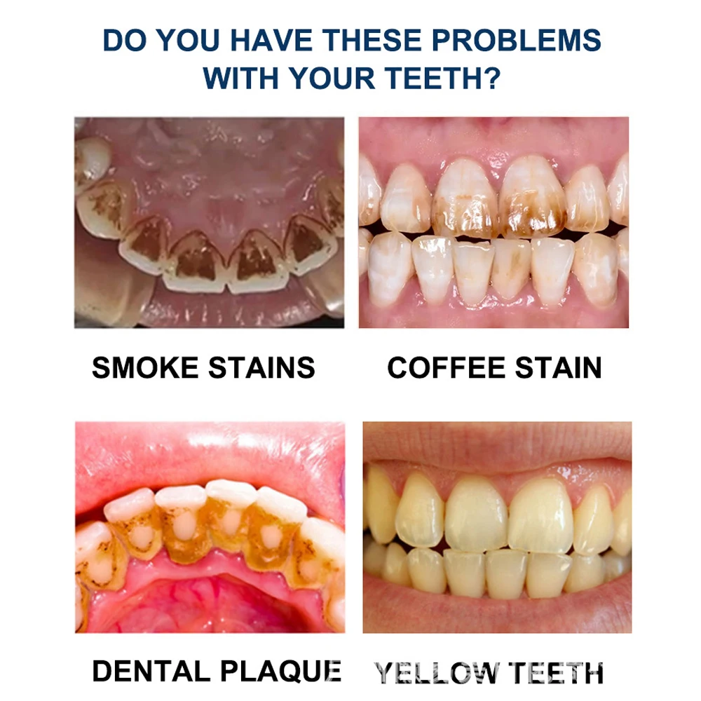 Smoking Teeth Before And After