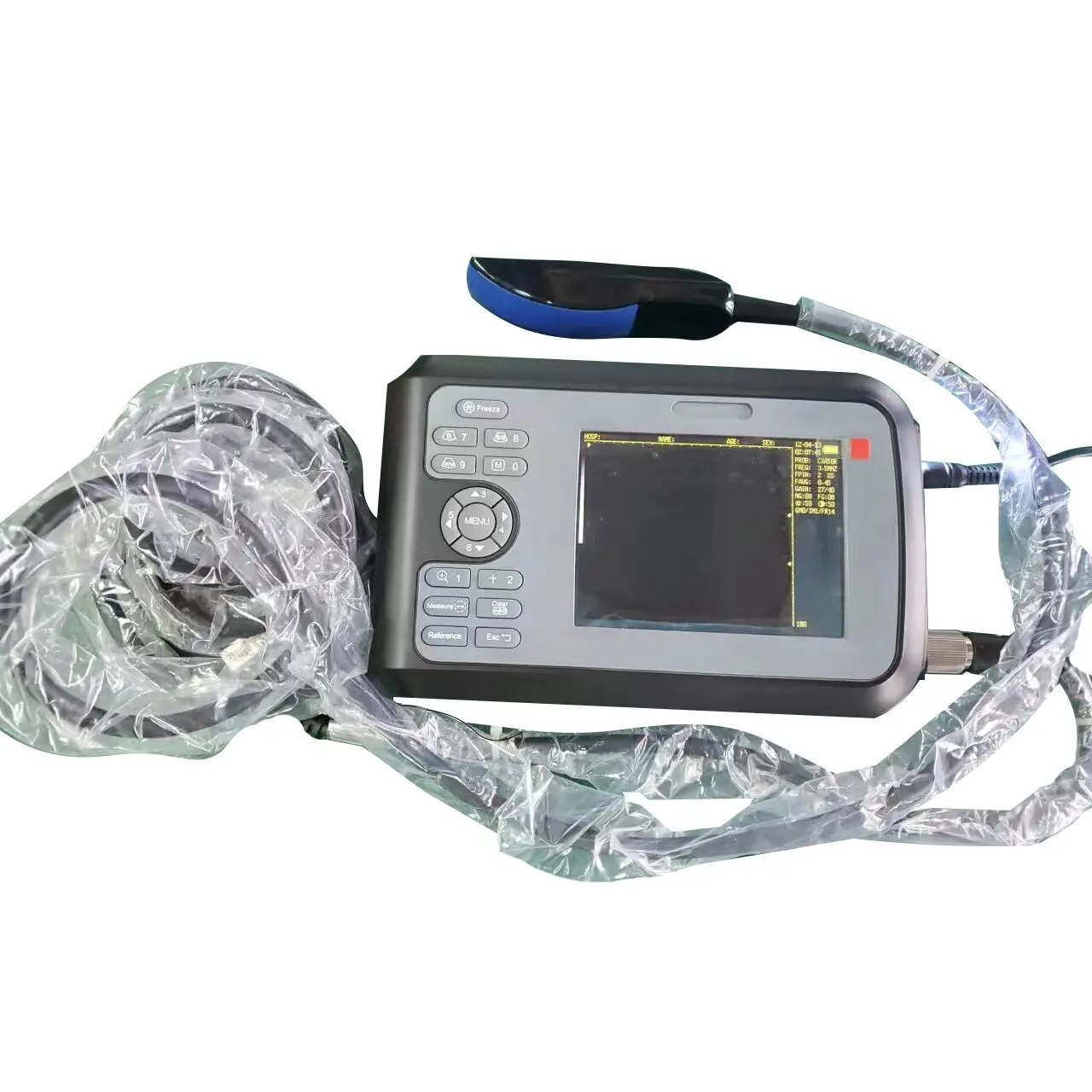 Horse-Sonar-Scanner-COW-Digital-Ultrasound-Veterinary-Ultrasonic ...