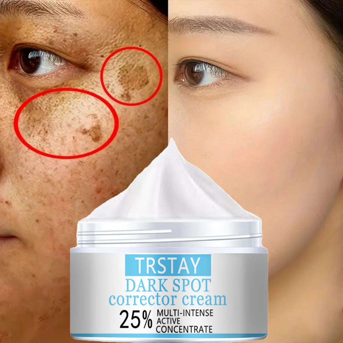 Natural-Extract-Lighten-Melanin-Essence-Face-Cream-Remove-Dark-Spot-Age ...