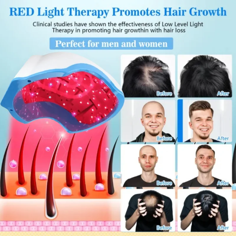 Professional Grade Red Light Therapy - NIR LED Hair Growth Cap for ...