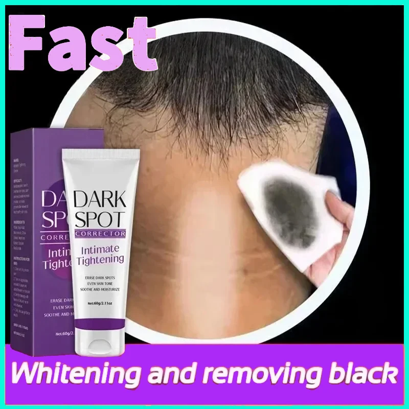 Nicotinamide-Brightening-Cream-For-Dark-Skin-Effective-Lighten-Thigh ...