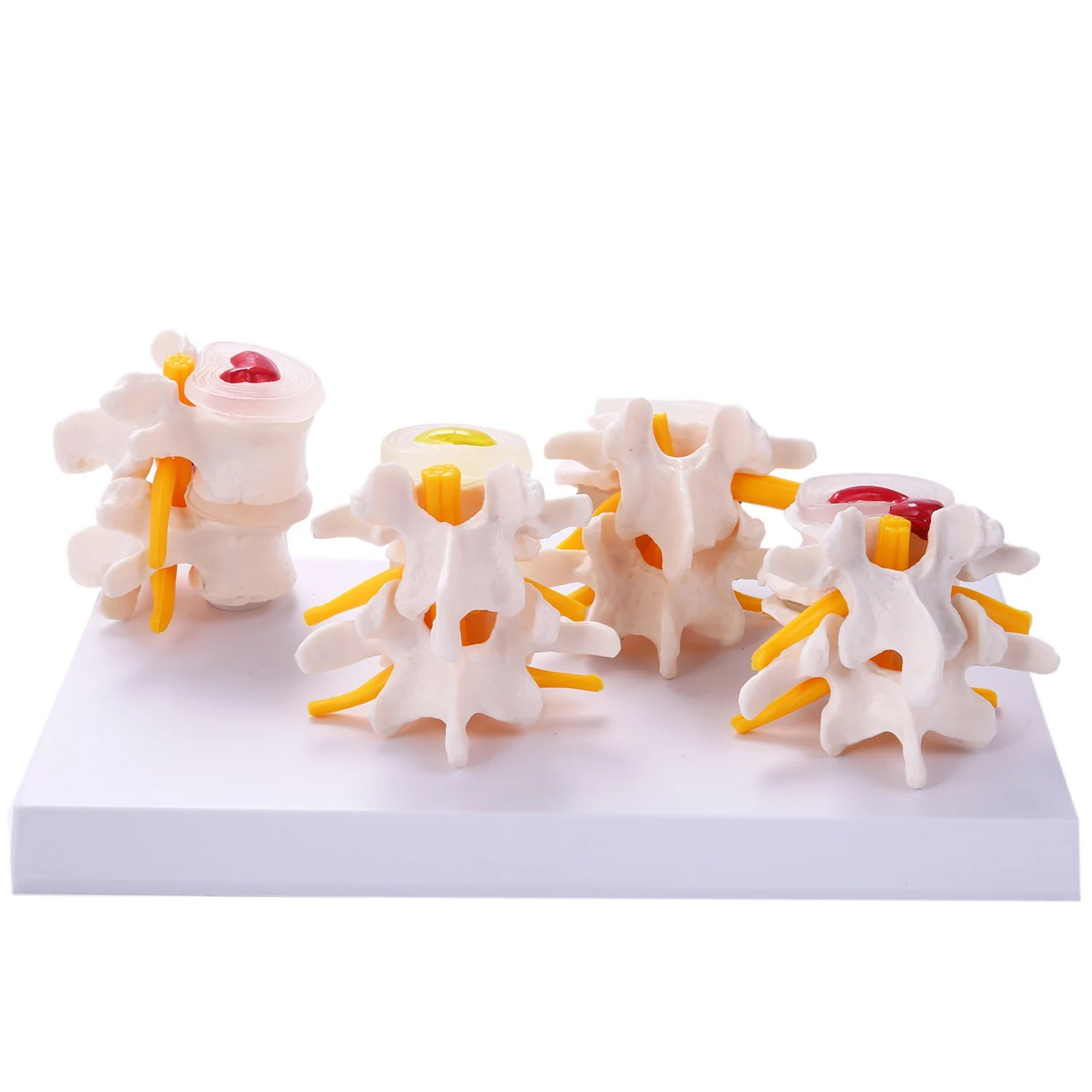 Human Anatomy Skeleton Spine 4-Stages Lumbar Vertebral Model Brain ...
