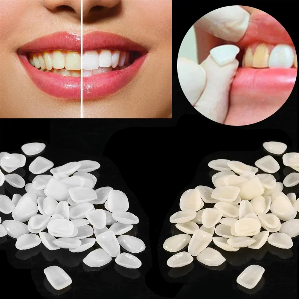 1Bag-Dental-Ultra-Thin-Anterior-Temporary-Crown-Whitening-Porcelain ...