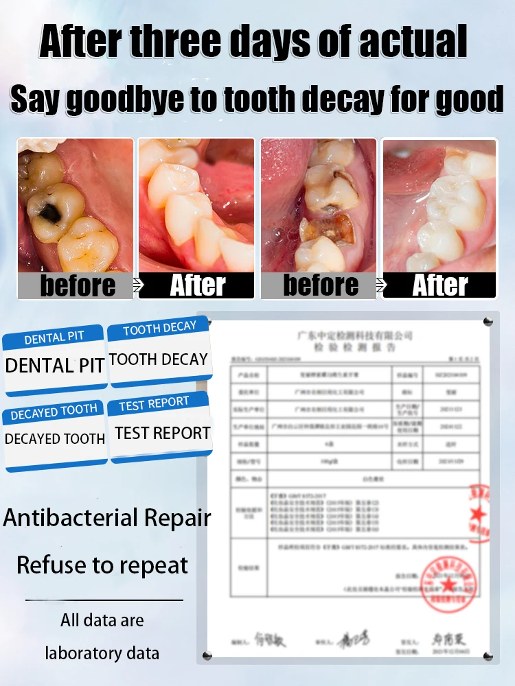 Toothache Cavity