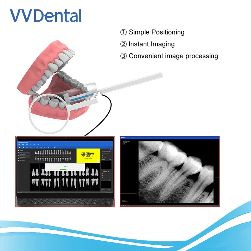 Dental-X-Ray-Digital-Sensor-Intraoral-Digital-System-HD-Image-Dentistry ...