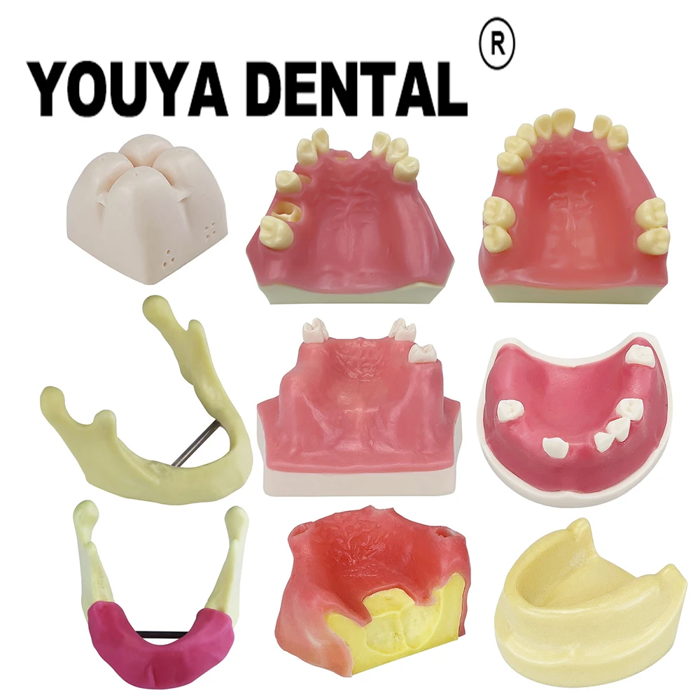 Dental-Maxillary-Implant-Practice-Model-Teeth-Teaching-Model-for ...
