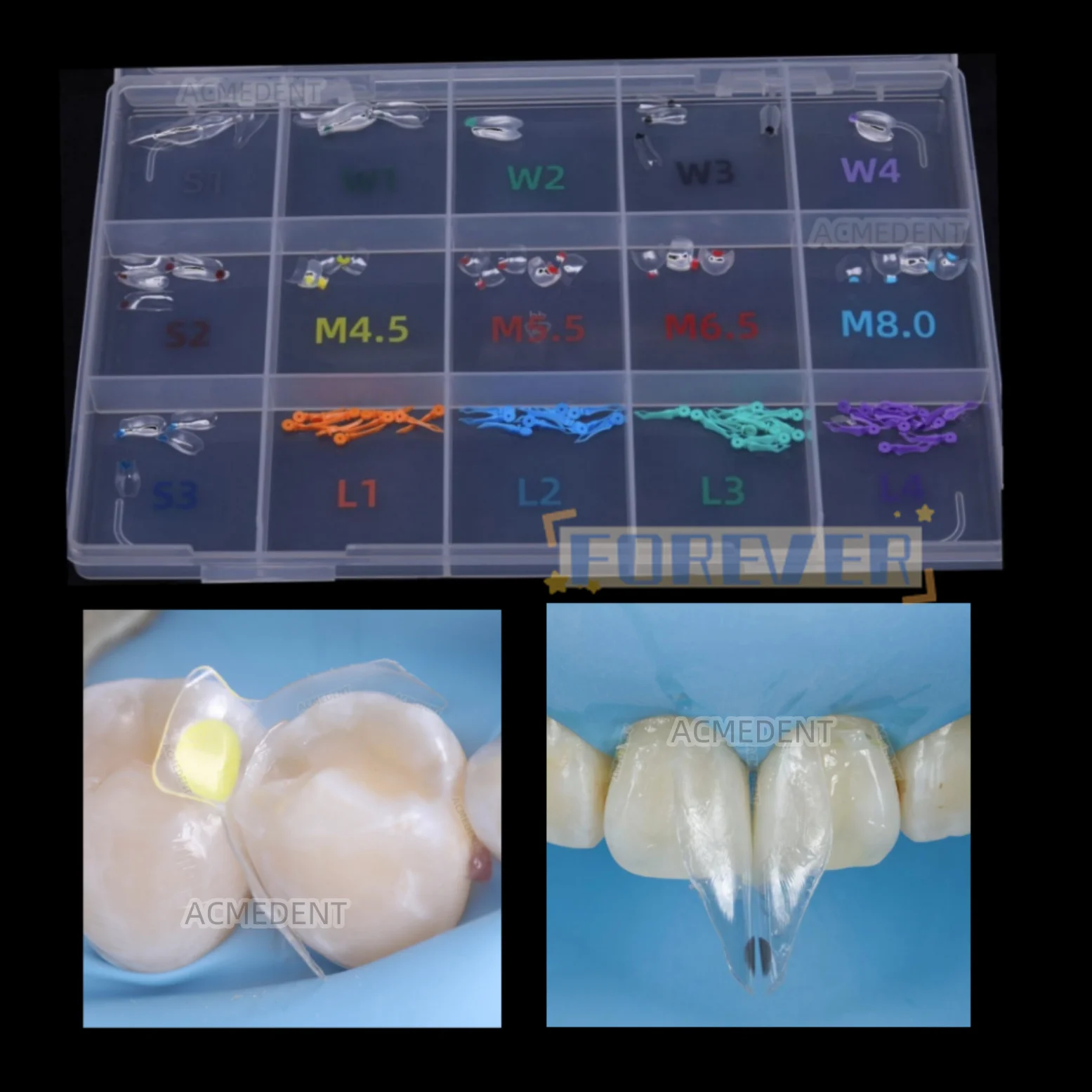 Dental-Clear-Matrix-Diastema-secional-preto-BT-Limpar-Matrizes-Bioclear-Fit.jpg
