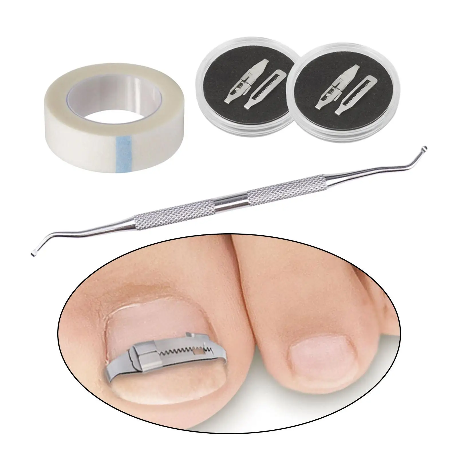 Ingrown-Toenail-Corrector-Toenail-Lifter-Recover-Top-Grade-Steel-Foot ...