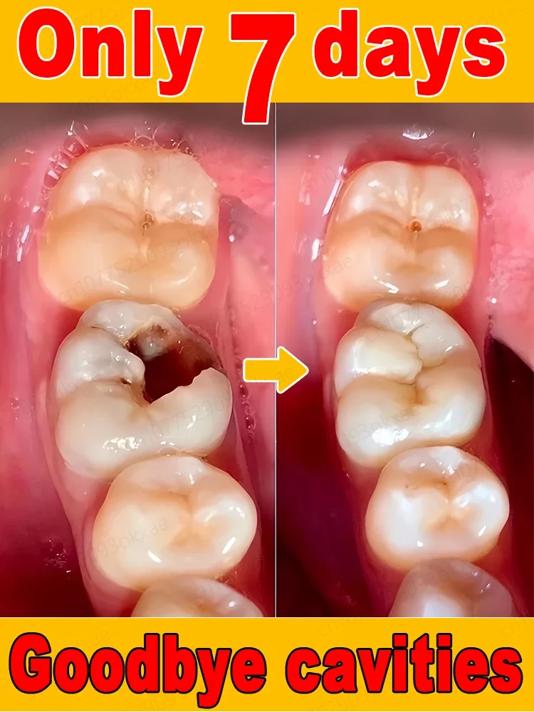 Use-natural-plant-extracts-to-repair-tooth-decay-whiten-teeth-and ...