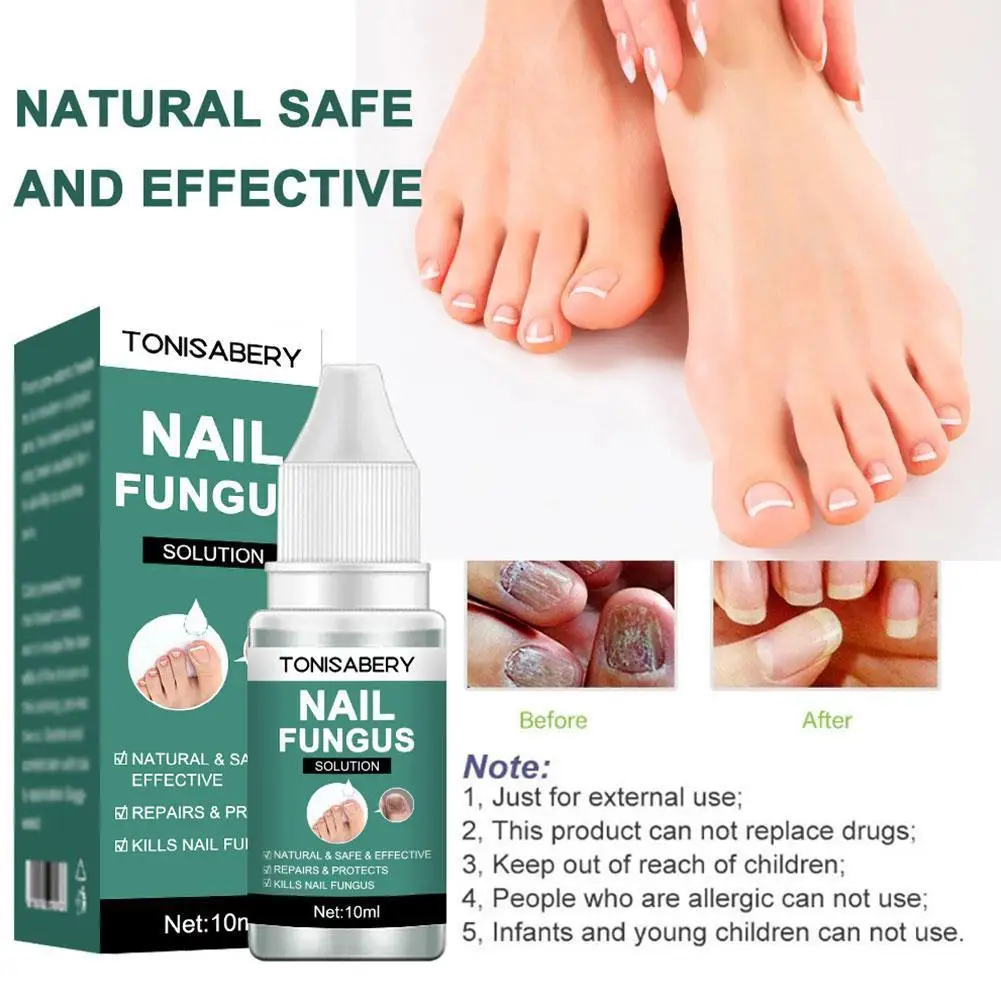 10ml-Nail-Fungus-Treatment-Serum-Foot-Repair-Liquid-Toe-Nails-Fungal ...