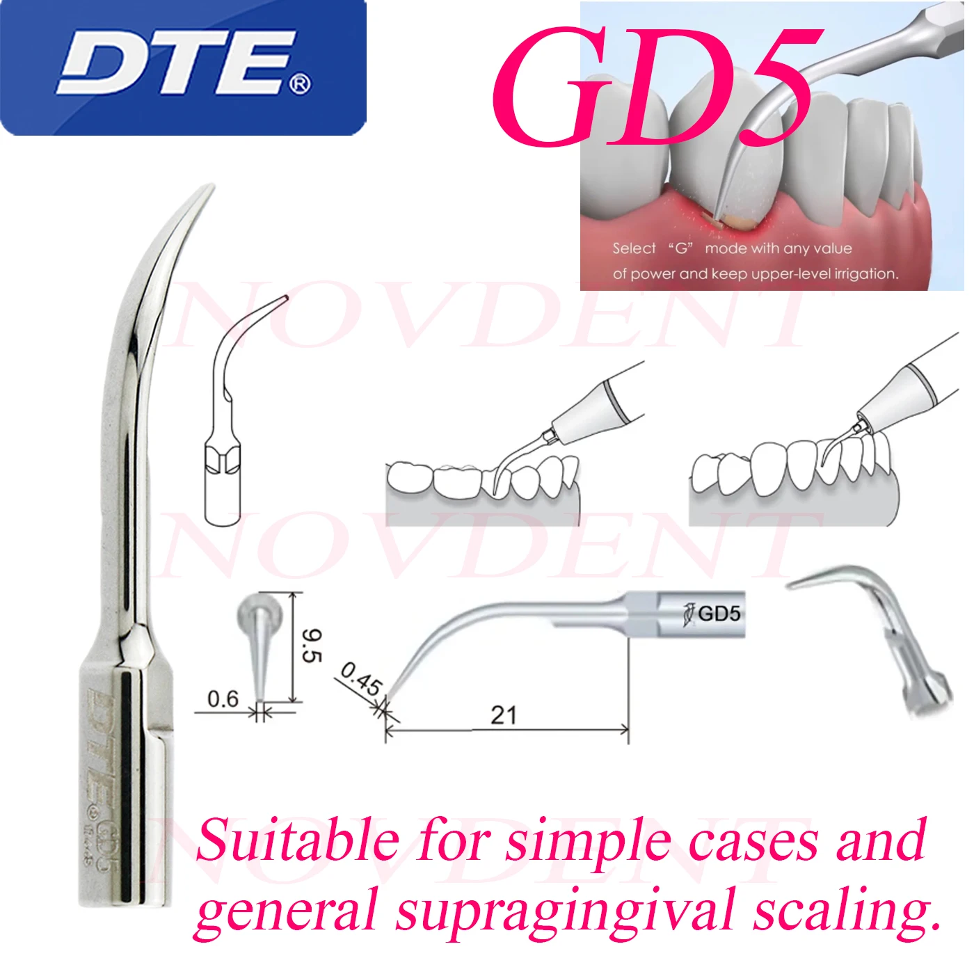 Woodpecker-Dental-DTE-Tool-Ultrasonic-Root-Canal-Working-Tip-Fit ...