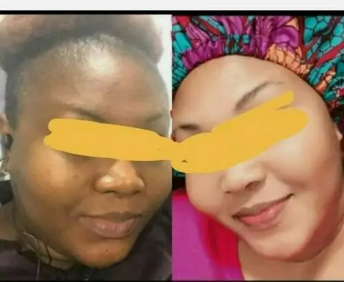 Whitenicious Cream: Real Results, Science-Backed Brightening, and What ...