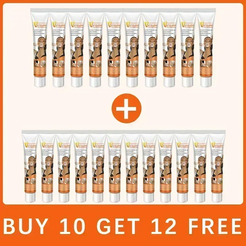 Crema de Vitiligo - Cuidado de la Piel de Vitiligo | Terapia natural de ...