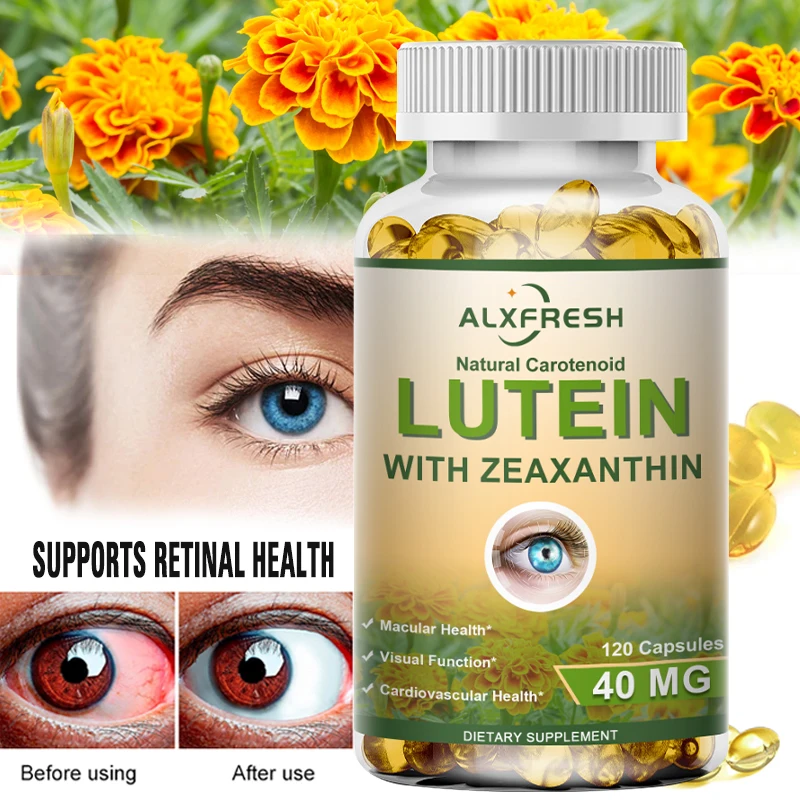 Alxfresh-c-psulas-de-Lutein-para-la-tensi-n-ocular-soporte-para-ojos-secos-antienvejecimiento ...