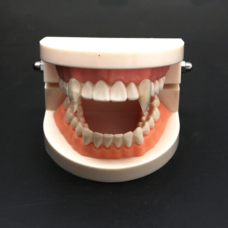 Permanent Vampire Teeth Implants
