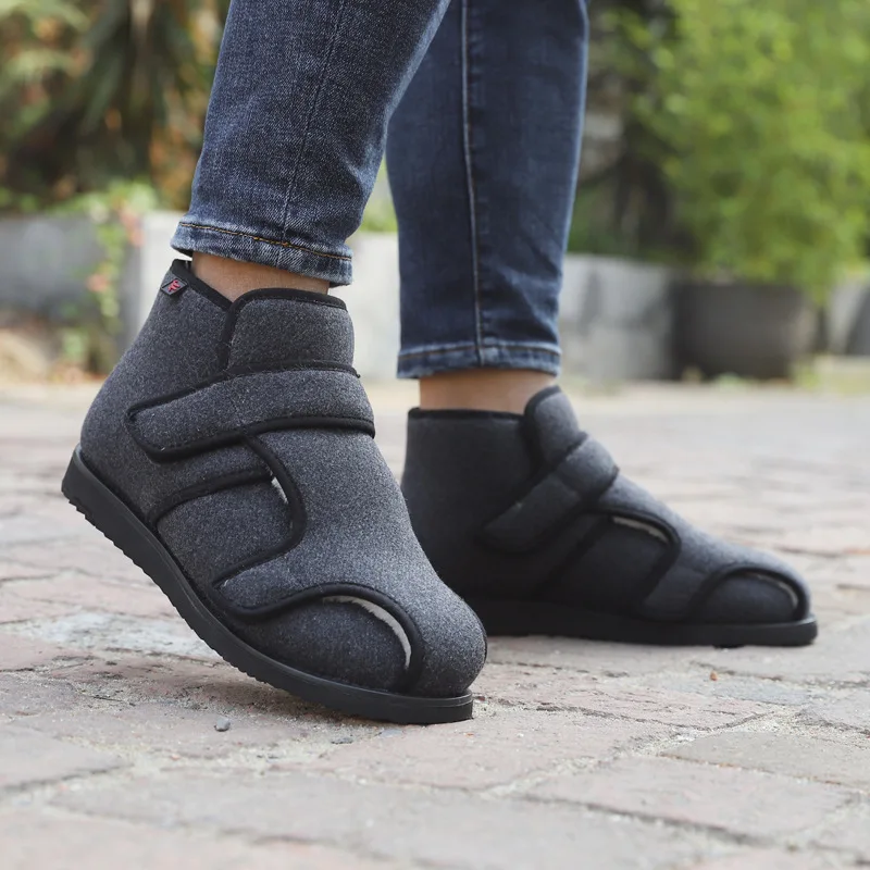 Widen The New Wool Shoes Fat Swelling Deformation of Hallux Valgus Foot ...