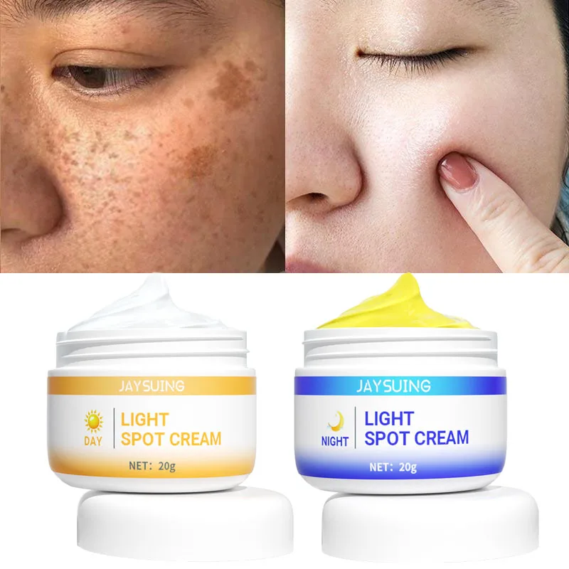 Crema blanqueadora para pecas, elimina manchas oscuras, Melasma, elimina cicatrices de acné ...