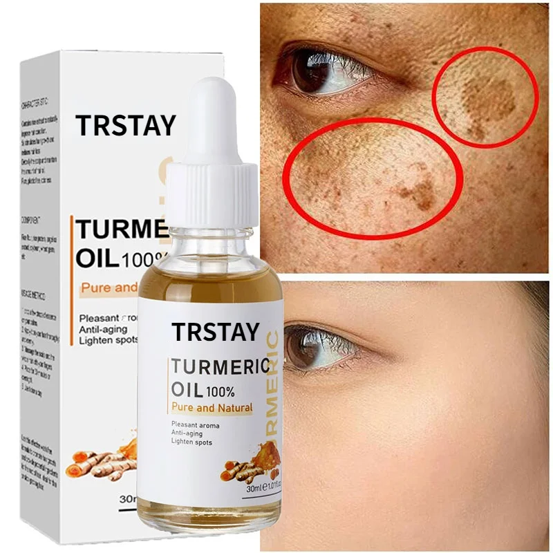 Turmeric-Melasma-Whitening-Correcting-Serum-Facial-Care-Essence-Oil ...