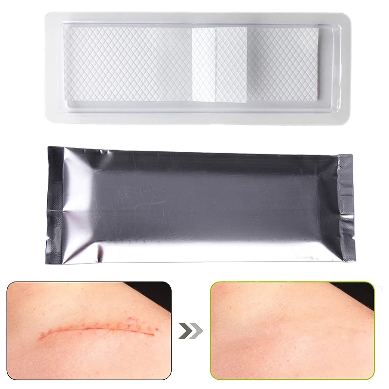 Reusable Scar Removal Sheet 12cm Breathable Silicone Patch For C ...