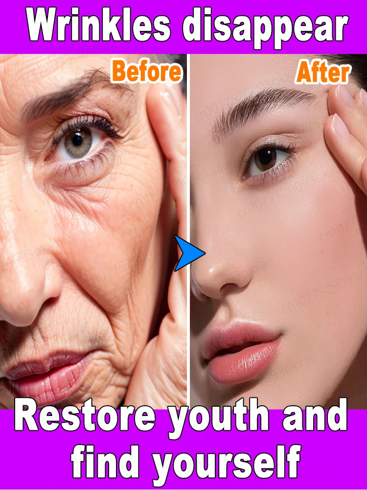 It-only-takes-7-days-to-get-rid-of-wrinkles-Anti-wrinkle-essential-oil ...