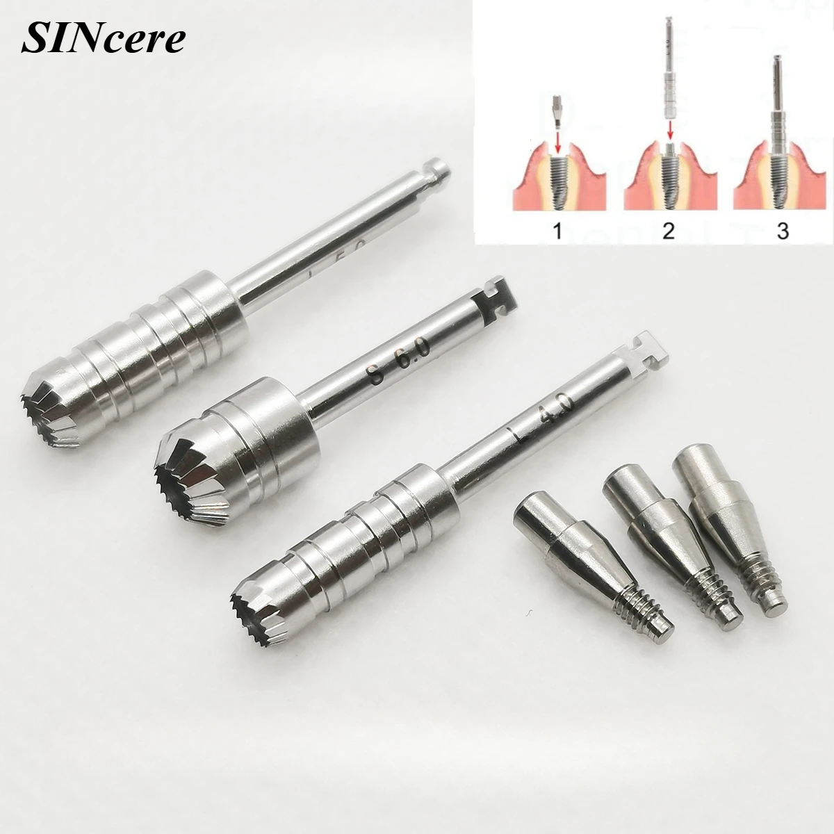 Dental Implant Bone Profiler Guide Screw Surgical Instrument Bone ...