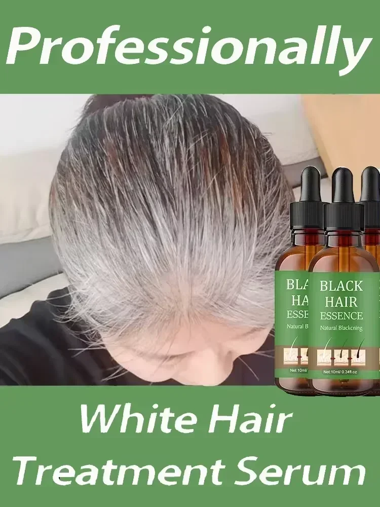 White-hair-killer-remove-gray-hair-and-restore-natural-hair-color-in-7 ...