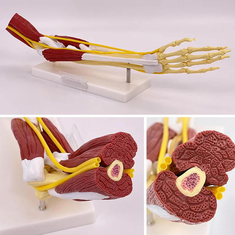 Medical-Anatomy-Muscled-Elbow-Joint-Model-Human-Arm-Vascular-Ligament ...