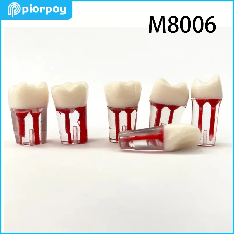 PIORPOY Dental Tooth Model Endodontic Blocks RCT Practice Pulp Cavity ...