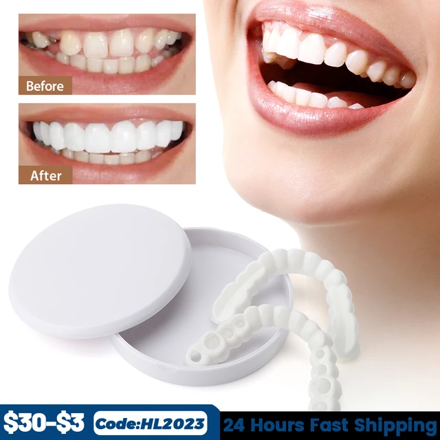 Perfect White Teeth With Braces