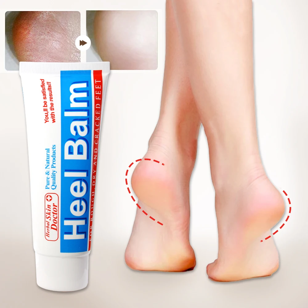 Herbal-Frostbite-Crack-Foot-Cream-Oil-Intensive-Foot-Repair-Foot-Cream ...
