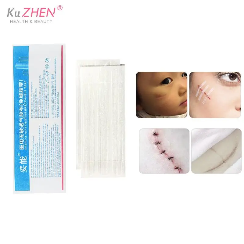 6/10Pcs Medical Surgical Tape No Need To Suture Skin Sterile Wound ...