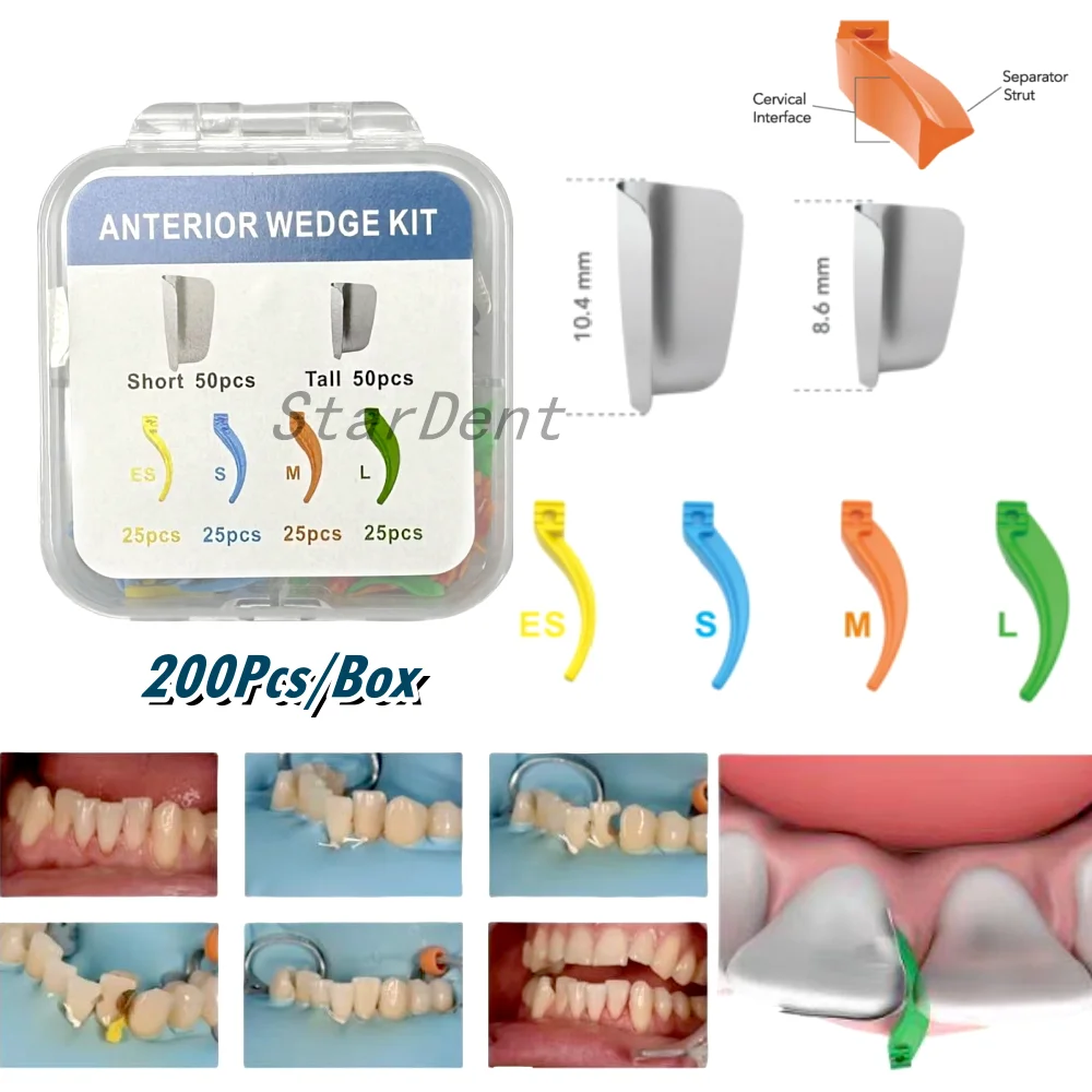Dental-Anterior-Matrices-System-Teeth-Wedge-Metal-Restoration-Sectional ...