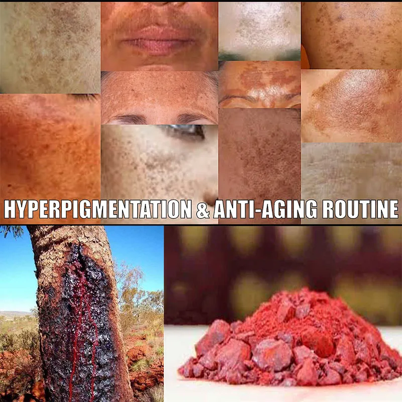 Strong-Korean-Whitening-Face-Cream-Kojic-Acid-for-Dark-Skin-Completely ...