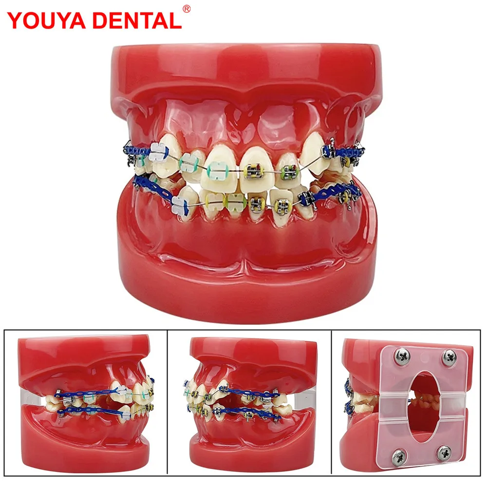 New Dental Orthodontic Treatment Model Orthodontic Teeth Model With ...