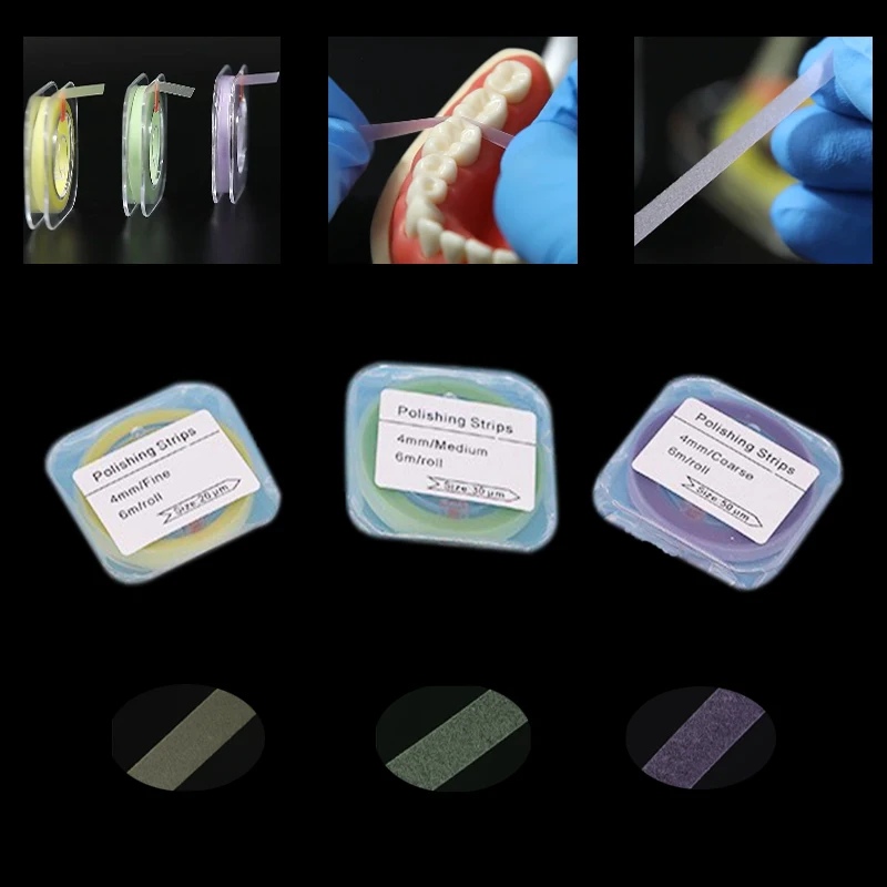 6m-Roll-Dental-Polishing-Strips-Polyester-Film-Matrix-Strips-Resin ...