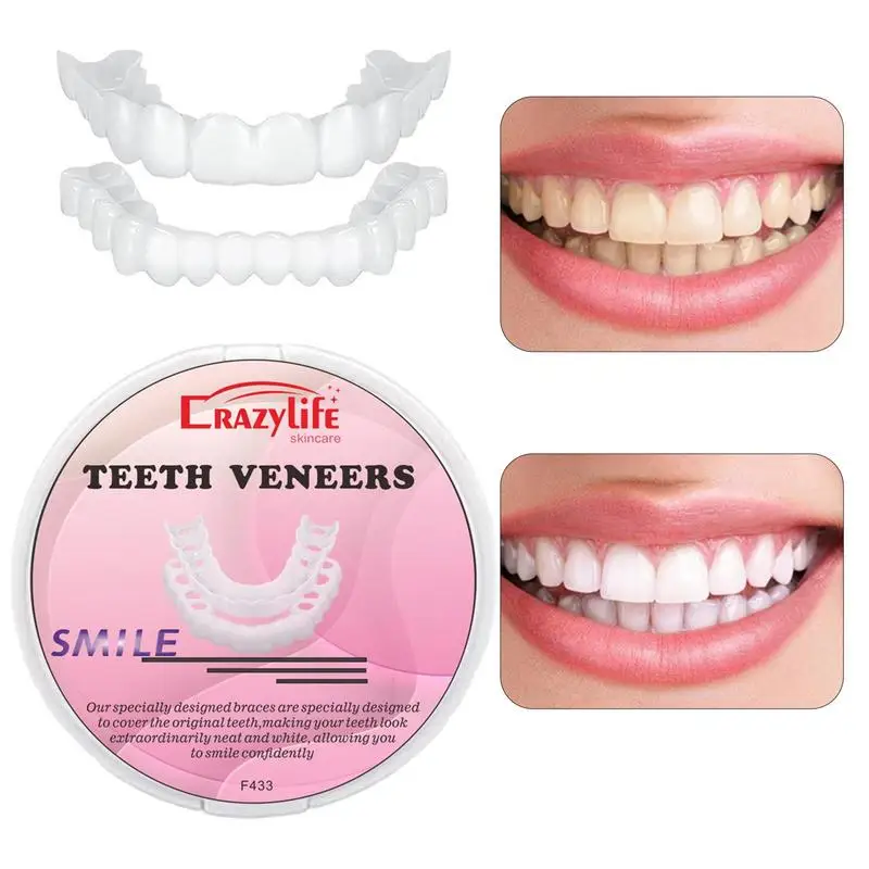 Perfect-Fit-Teeth-Whitening-Fake-Tooth-Cover-Snap-On-Silicone-Smile ...