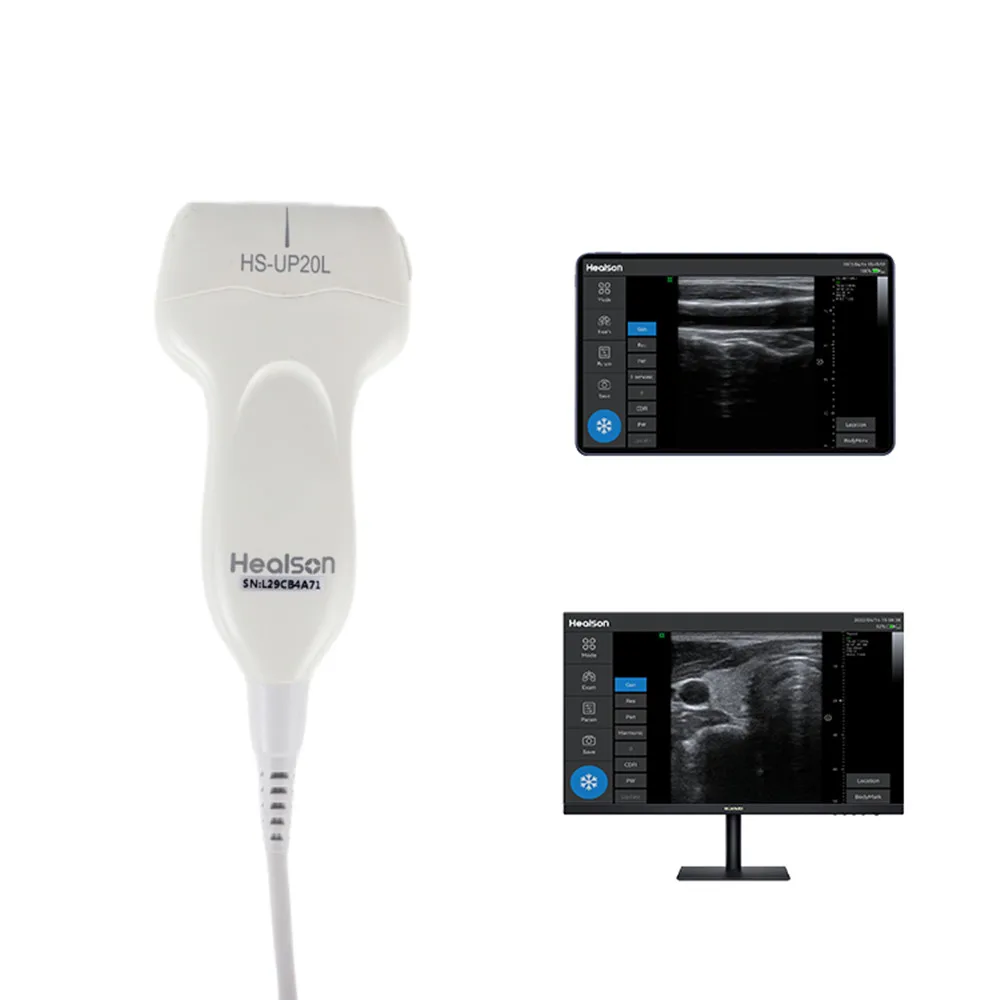 Healson B&W Pocket Linear Handheld Digital Ultrasound Probe Portable ...