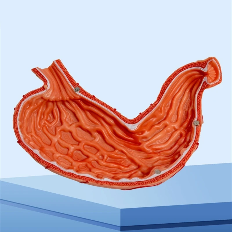 Stomach Anatomy Model, Anatomical Duodenum Pancreas Model Human Organs ...
