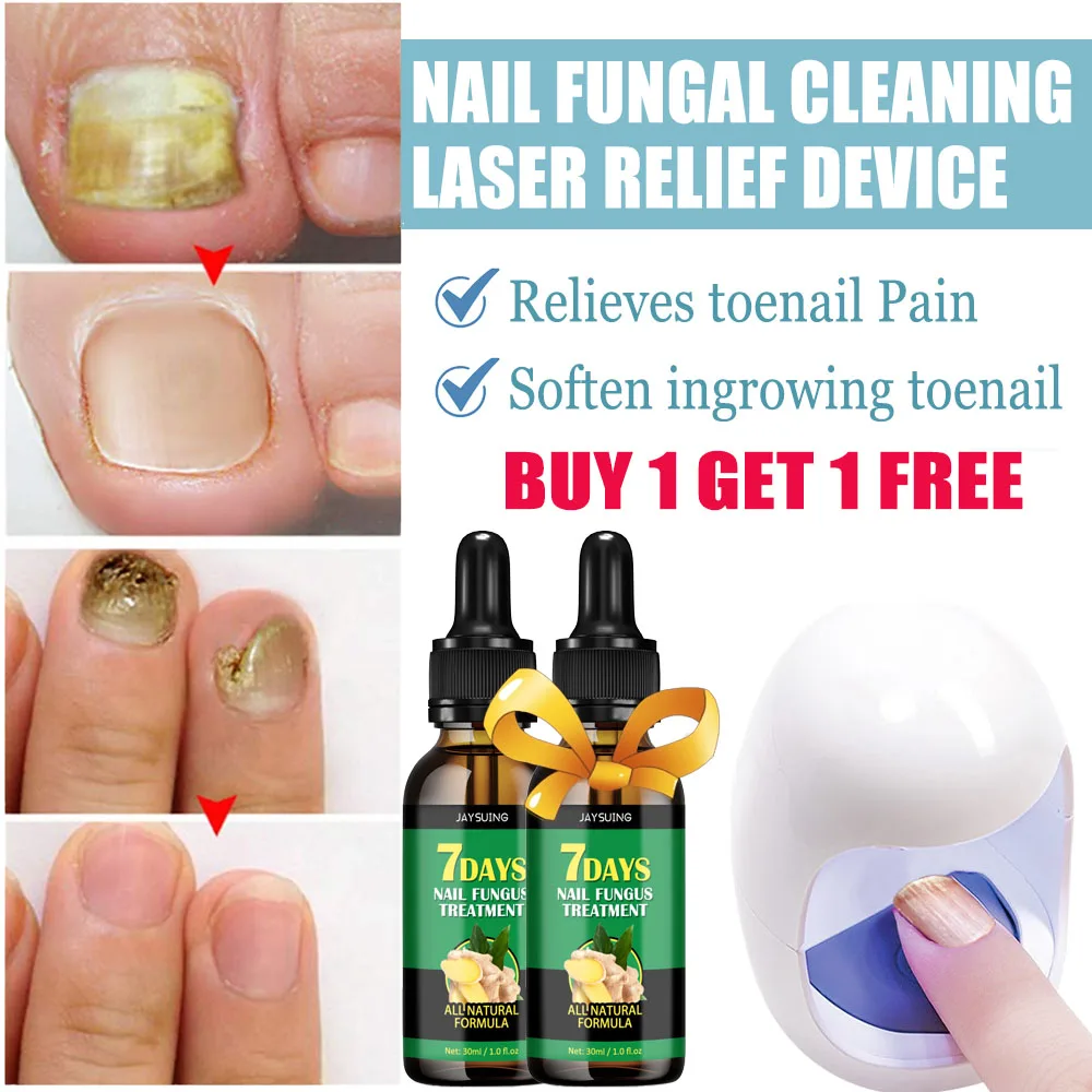 Nail-Fungus-Laser-Treatment-Device-Repair-Toenail-Fingernail-Essential ...