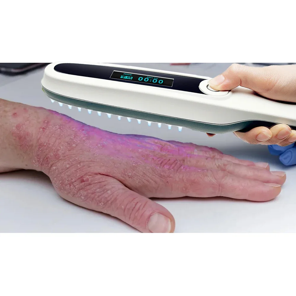 narrowband-phototherapy-lamp-portable-handheld-medical-light-source ...