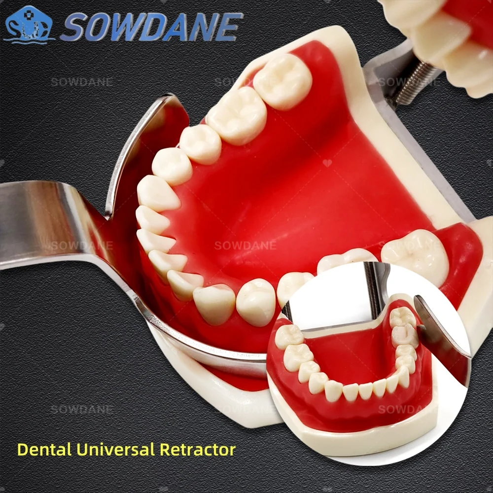 Dental Universal Retrator Cheeck and Lip Retractor Implant Vestibulum ...