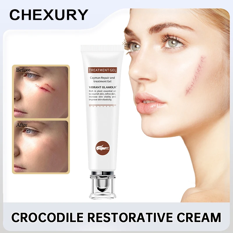 Crocodile-Scar-Repair-Cream-Removes-Scars-Fades-Stretch-Marks-Repairs ...